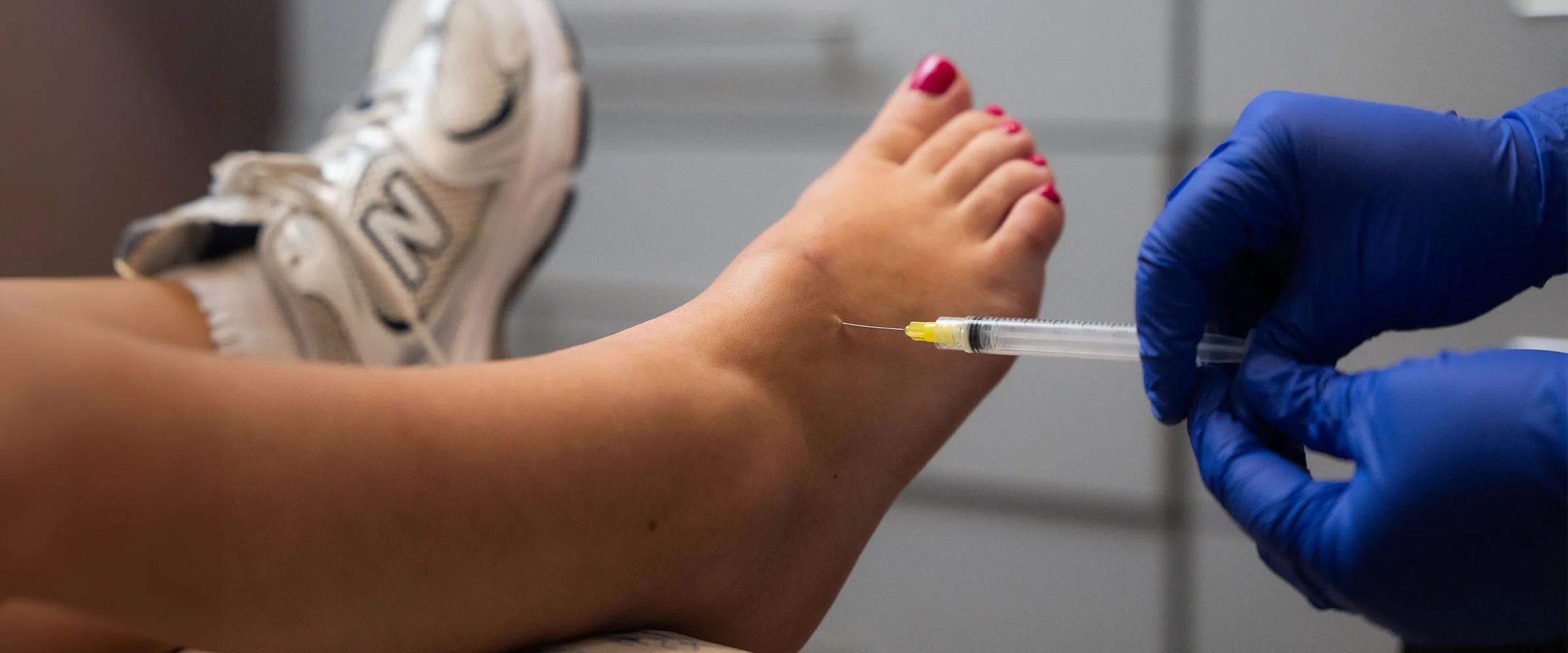 Platelet Rich Plasma (PRP) In In The Feet In New York City | AIRE ...