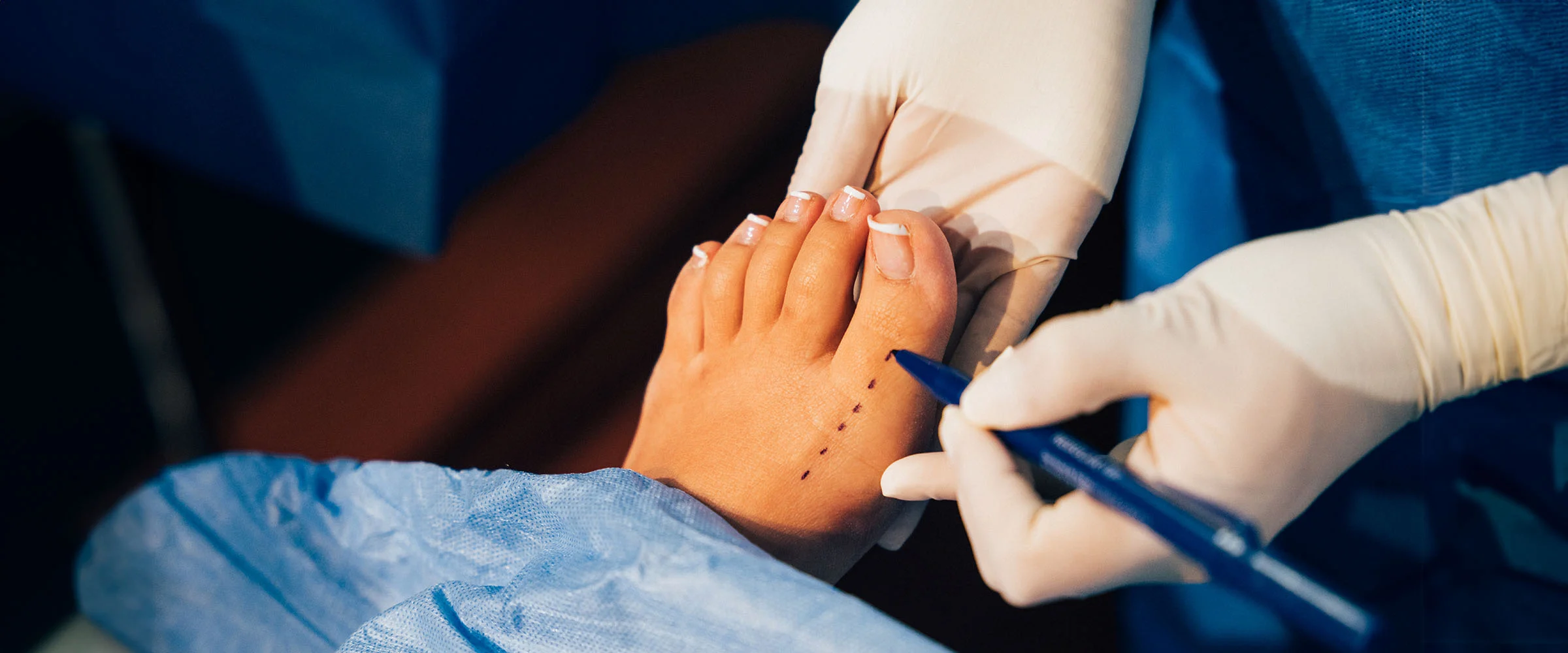 Bunion Treatments In New York City | AIRE Podiatry Studio